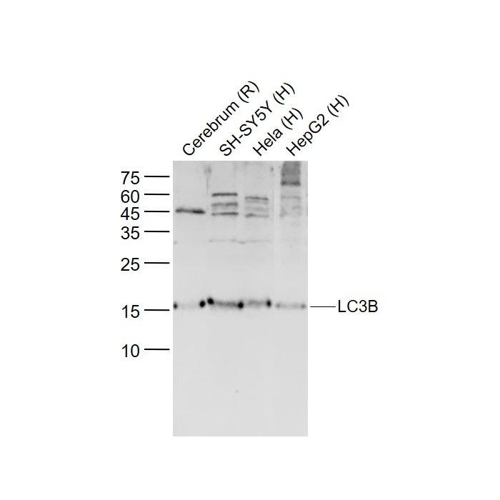 Anti-LC3B antibody (bs-4843R) - 上海信裕生物 - 信裕生物-试剂盒,ELISA试剂盒, 检测试剂盒,抗体,细胞 ...