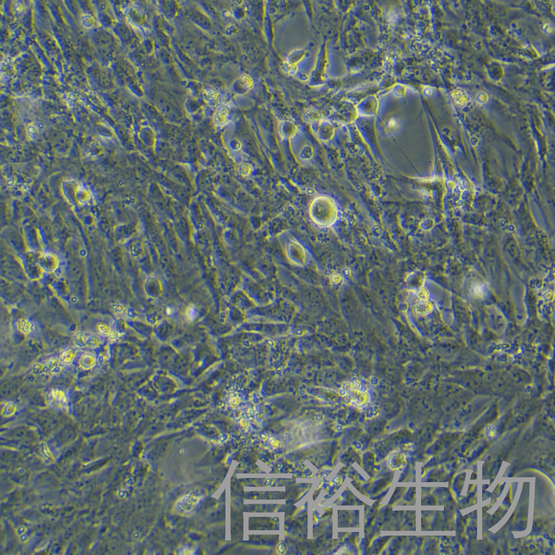 SVGP12（人星形胶质细胞）XY-H997 - 上海信裕生物 - 信裕生物-试剂盒,ELISA试剂盒, 检测试剂盒,抗体,细胞系,原代细胞 ...