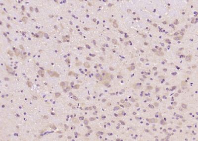 Anti-LC3B antibody (bs-4843R) - 上海信裕生物 - 信裕生物-试剂盒,ELISA试剂盒, 检测试剂盒,抗体,细胞 ...