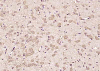 Anti-LC3B antibody (bs-4843R) - 上海信裕生物 - 信裕生物-试剂盒,ELISA试剂盒, 检测试剂盒,抗体,细胞 ...