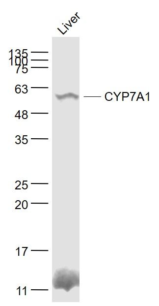 Anti-CYP7A1 antibody (bs-21429R) - 上海信裕生物 - 信裕生物-试剂盒,ELISA试剂盒, 检测试剂盒,抗体 ...